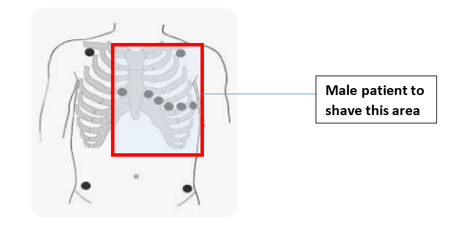Treadmill Stress Test | IMC Medical Clinic